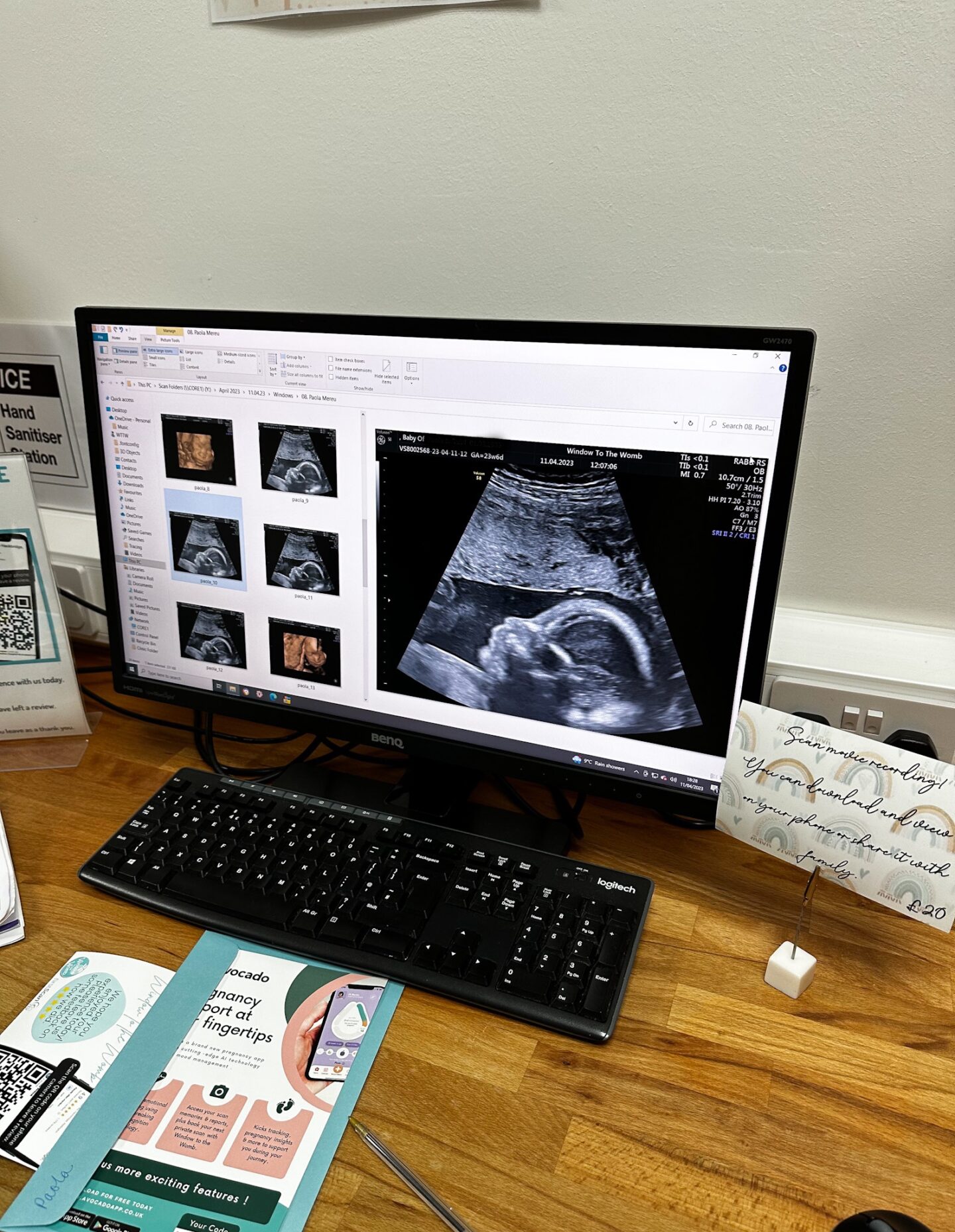 Window to the womb - 4D scan and fetal well being scan review - Vanity Owl